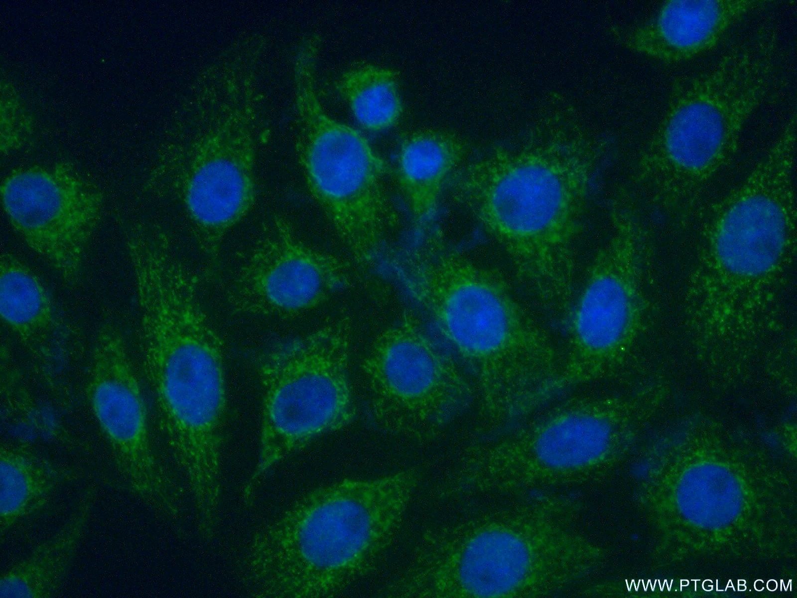 PARK2/Parkin Antibody 14060-1-AP | Proteintech